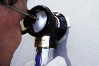 Surface Profile Measurement Options on Rough/Pitted Steel Surfaces